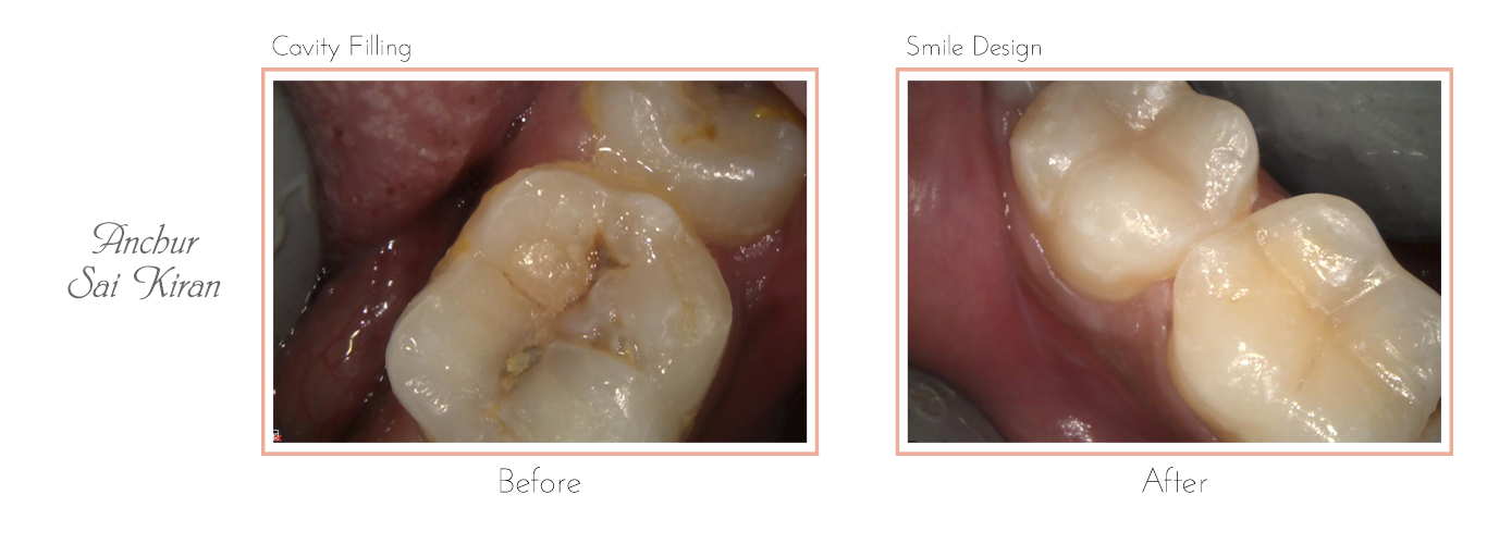 Studio Dental - Best Dental Hospital in Hyderabad - Dental Clinic ...