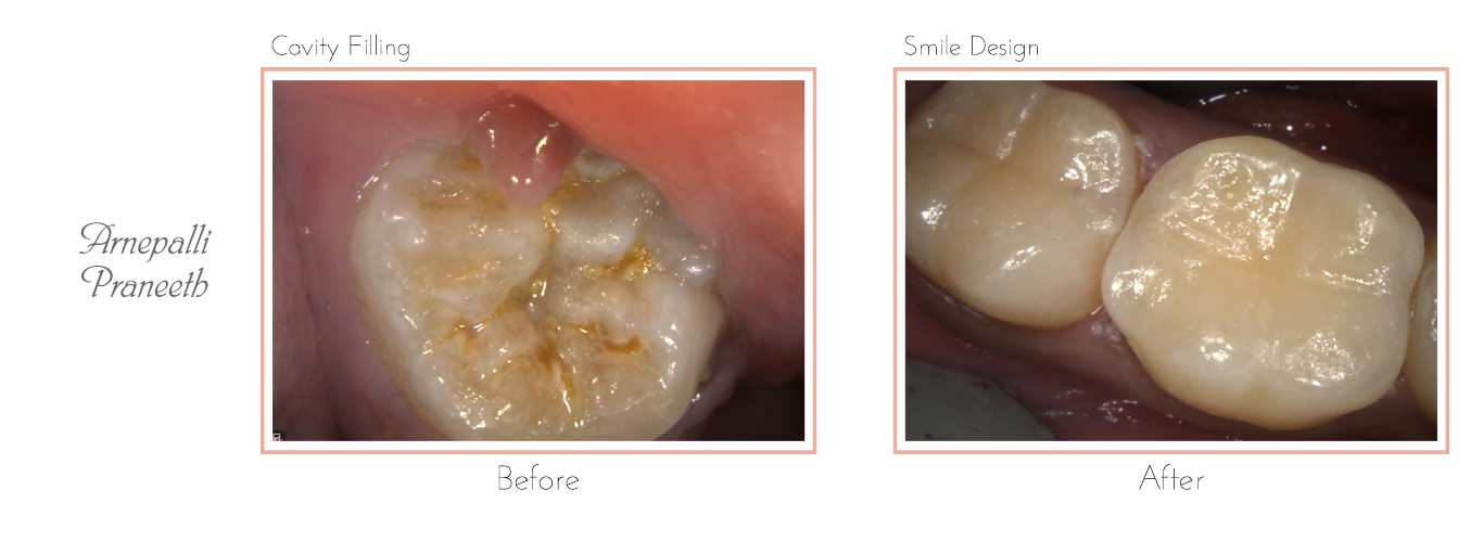 Studio Dental - Best Dental Hospital in Hyderabad - Dental Clinic ...