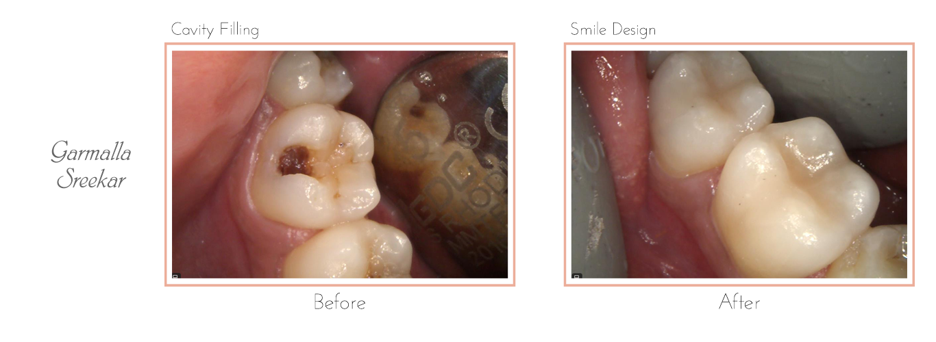 Studio Dental - Best Dental Hospital in Hyderabad - Dental Clinic ...